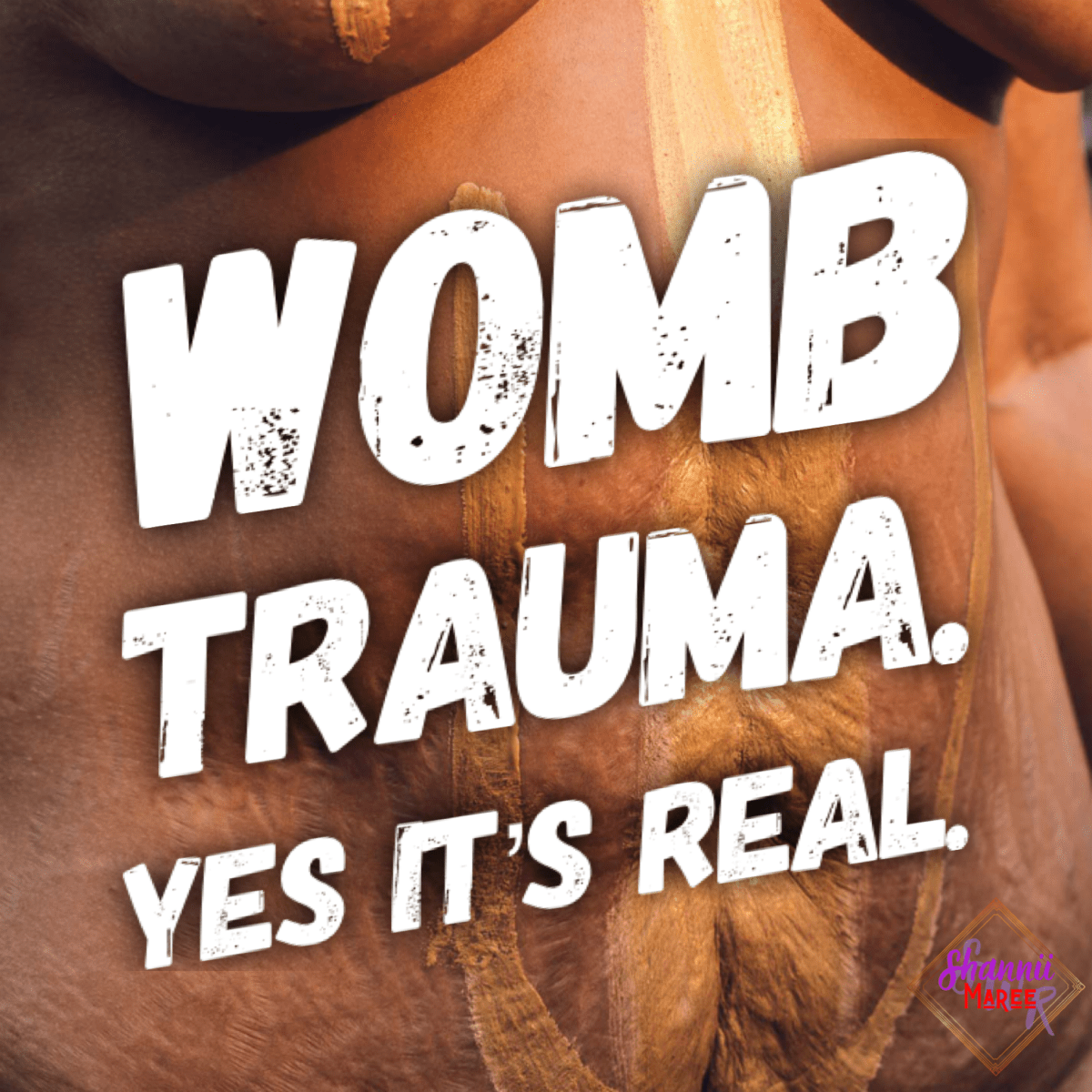Womb Trauma. Yes it’s real. – Shannii Maree – Strong Without Realising